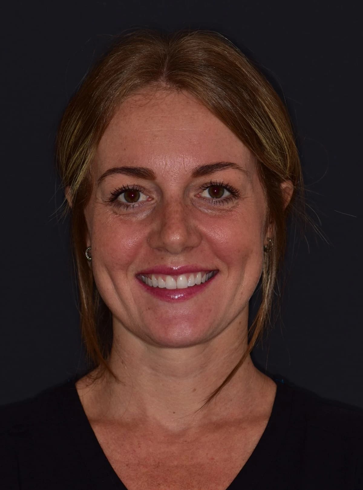 About Us | Meet The Team | Taverham Dental